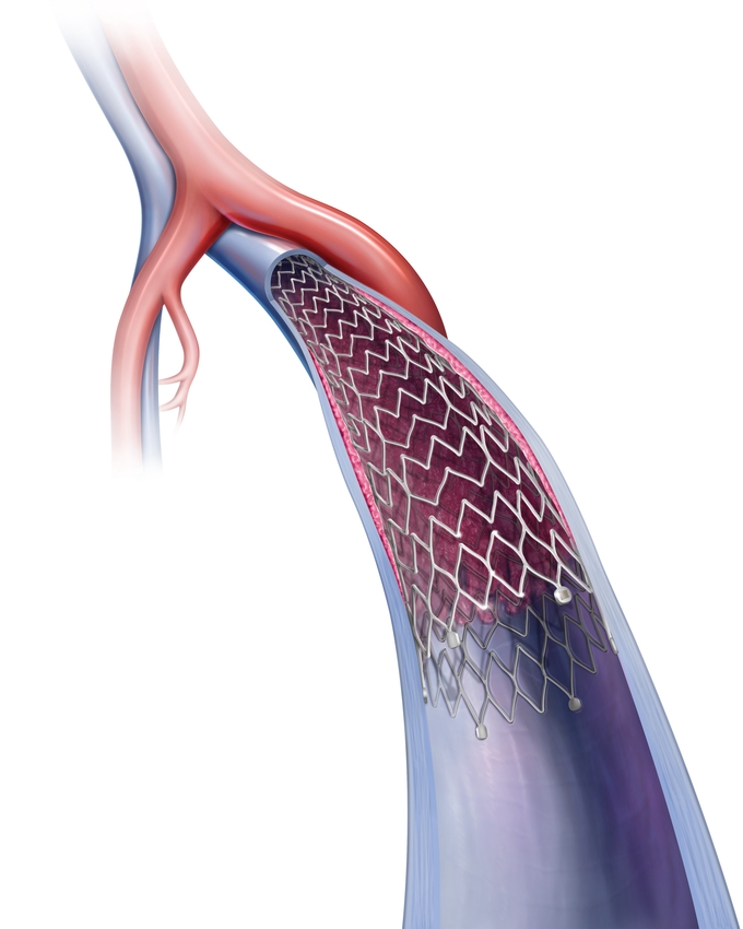 BD코리아, 정맥전용 스텐트 ‘베노보(Venovo™)’ 재출시